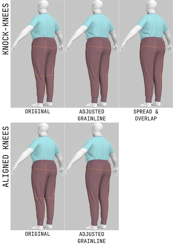 Review of a Slash and Overlap Method to Alter Patterns for Knock Knees ...