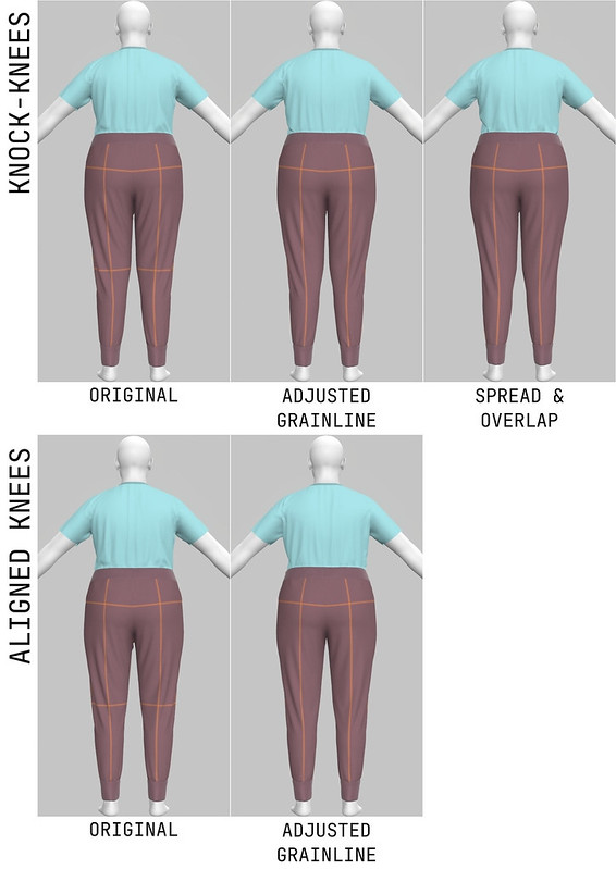 Review of a Slash and Overlap Method to Alter Patterns for Knock Knees ...