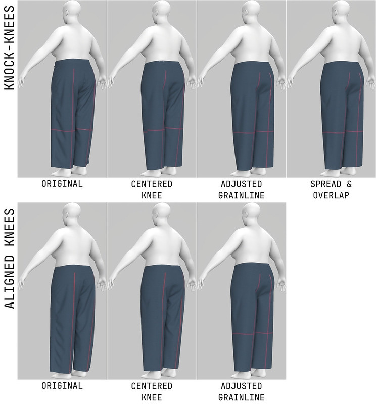 Review of a Slash and Overlap Method to Alter Patterns for Knock Knees ...