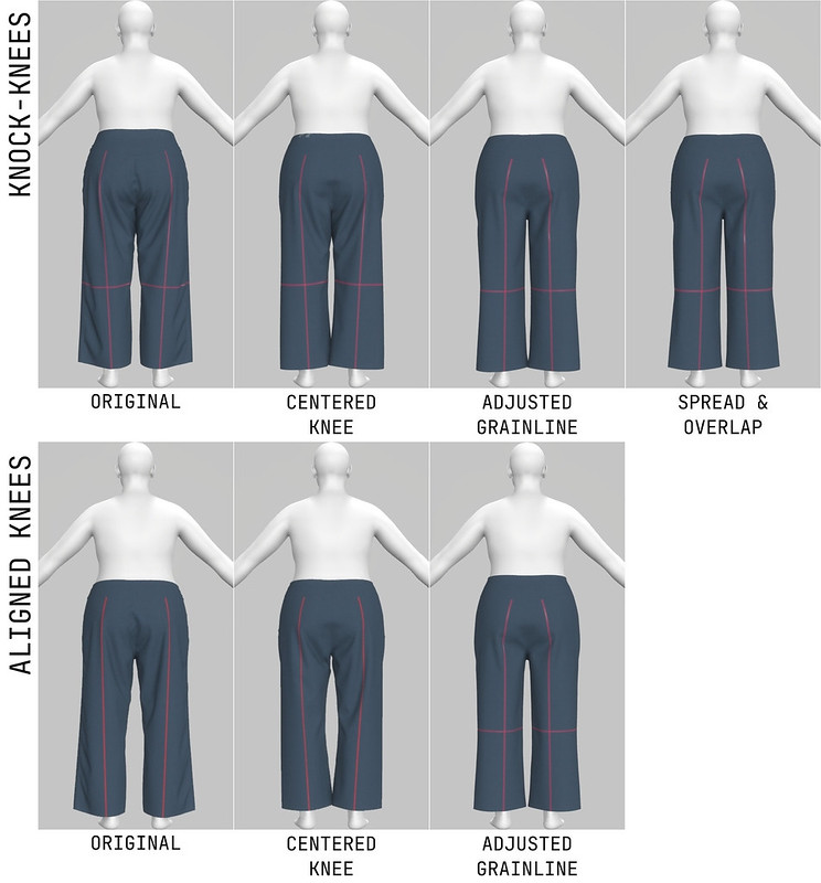 Review of a Slash and Overlap Method to Alter Patterns for Knock Knees ...