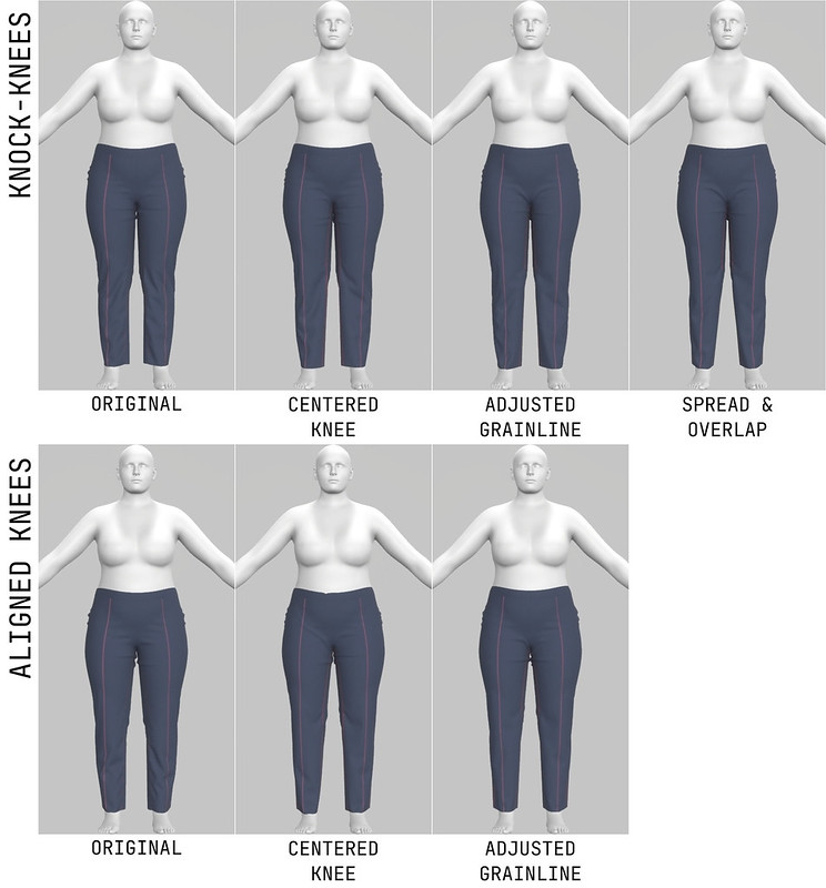 Review of a Slash and Overlap Method to Alter Patterns for Knock Knees ...