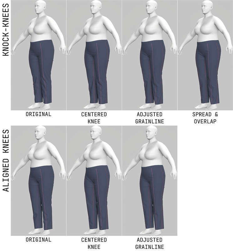 Review of a Slash and Overlap Method to Alter Patterns for Knock Knees ...