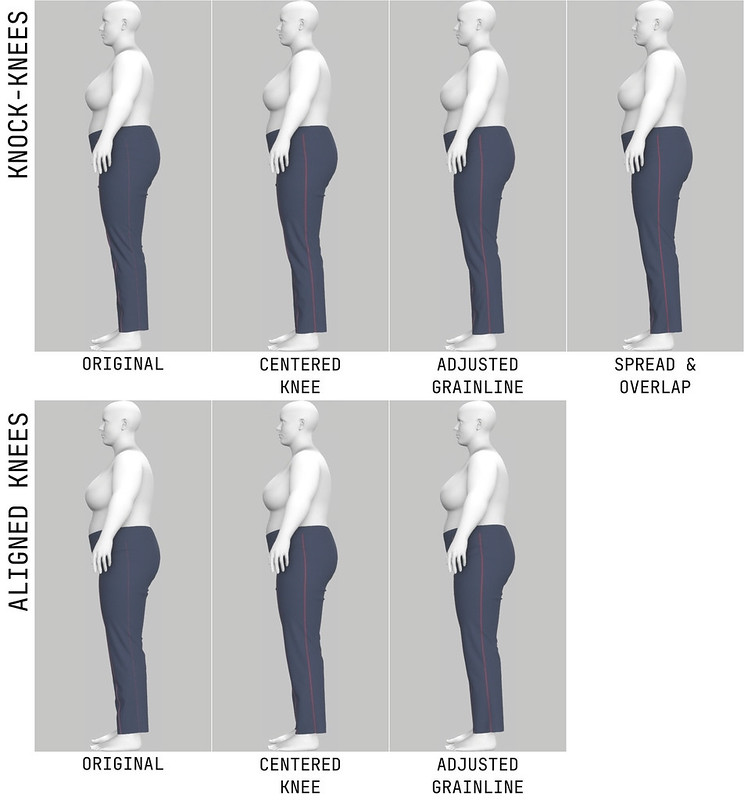 Review of a Slash and Overlap Method to Alter Patterns for Knock Knees ...