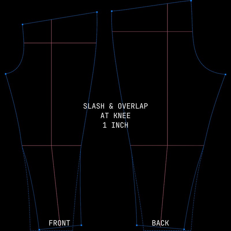 Review of a Slash and Overlap Method to Alter Patterns for Knock Knees ...
