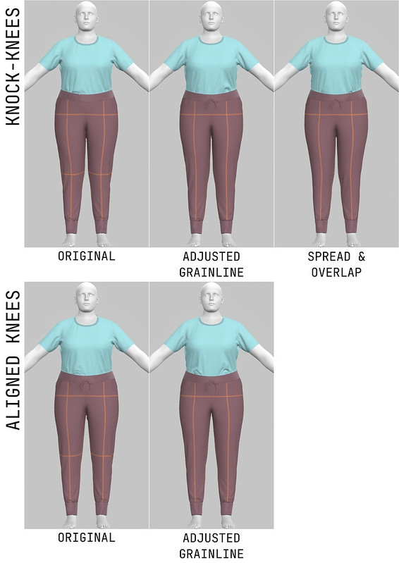 Review of a Slash and Overlap Method to Alter Patterns for Knock Knees ...